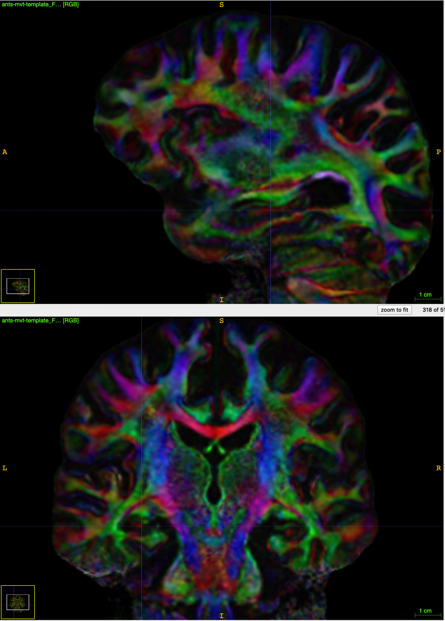 Work in Progress – Human Brain Atlas